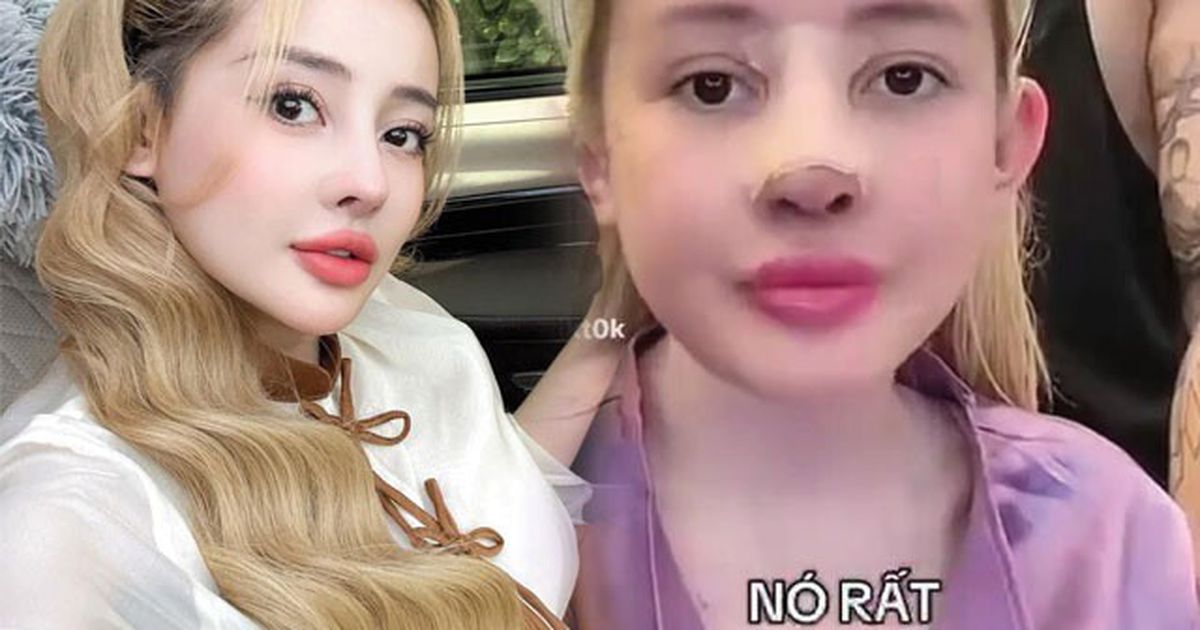 Ngân 98 ngất xỉu khi tháo sụn mũi giả, sau 12 lần sửa giờ phải lấy mỡ ...